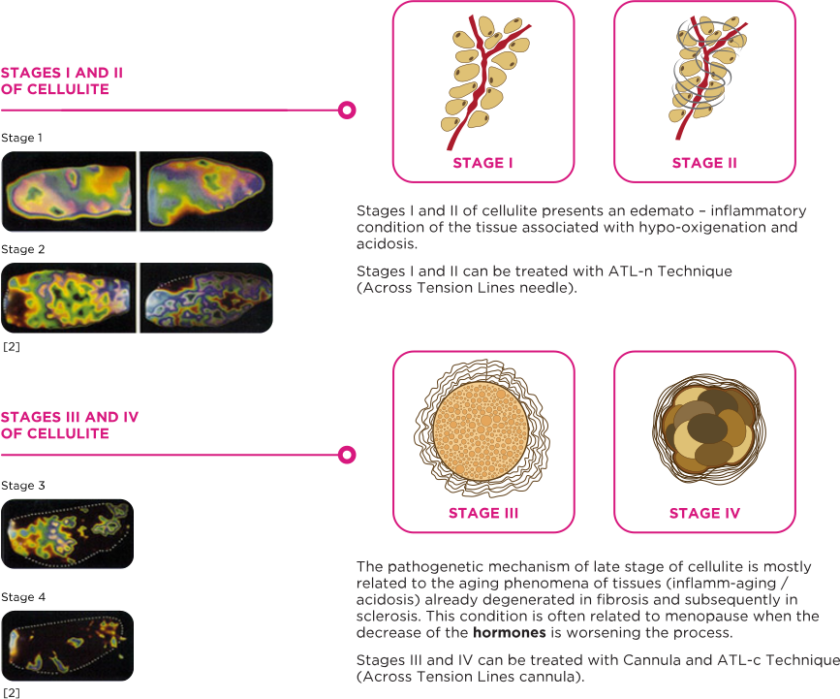 Sunekos Cell 15 -Cellulite – Gerka Clinic